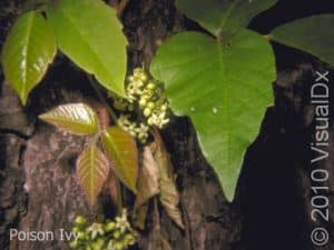 Poison Ivy, Oak, and Sumac Condition, Treatments and Pictures for ...