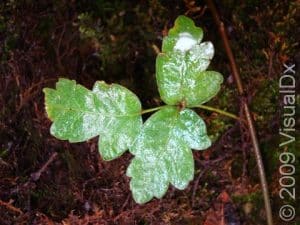 Poison Ivy, Oak, and Sumac Condition, Treatments and Pictures for ...