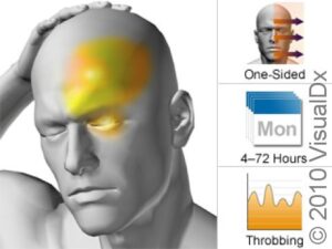 Common and Classical Migraine Condition, Treatments and Pictures for ...